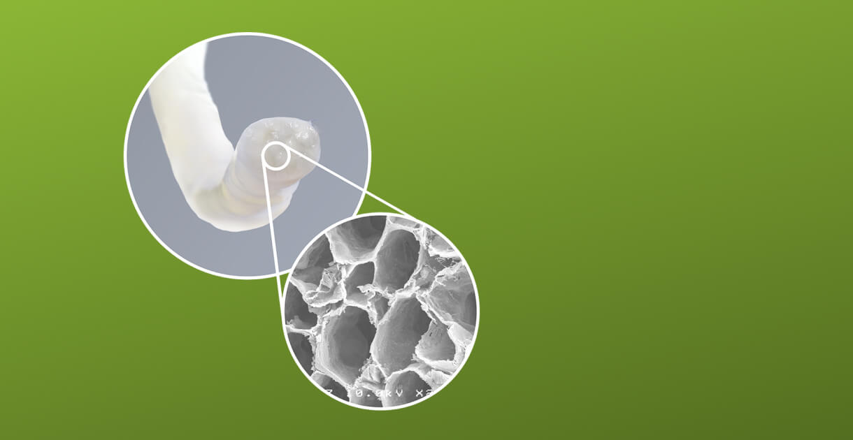 Avance® - FDA-Approved Acellular Nerve Allograft-arwx | Axogen